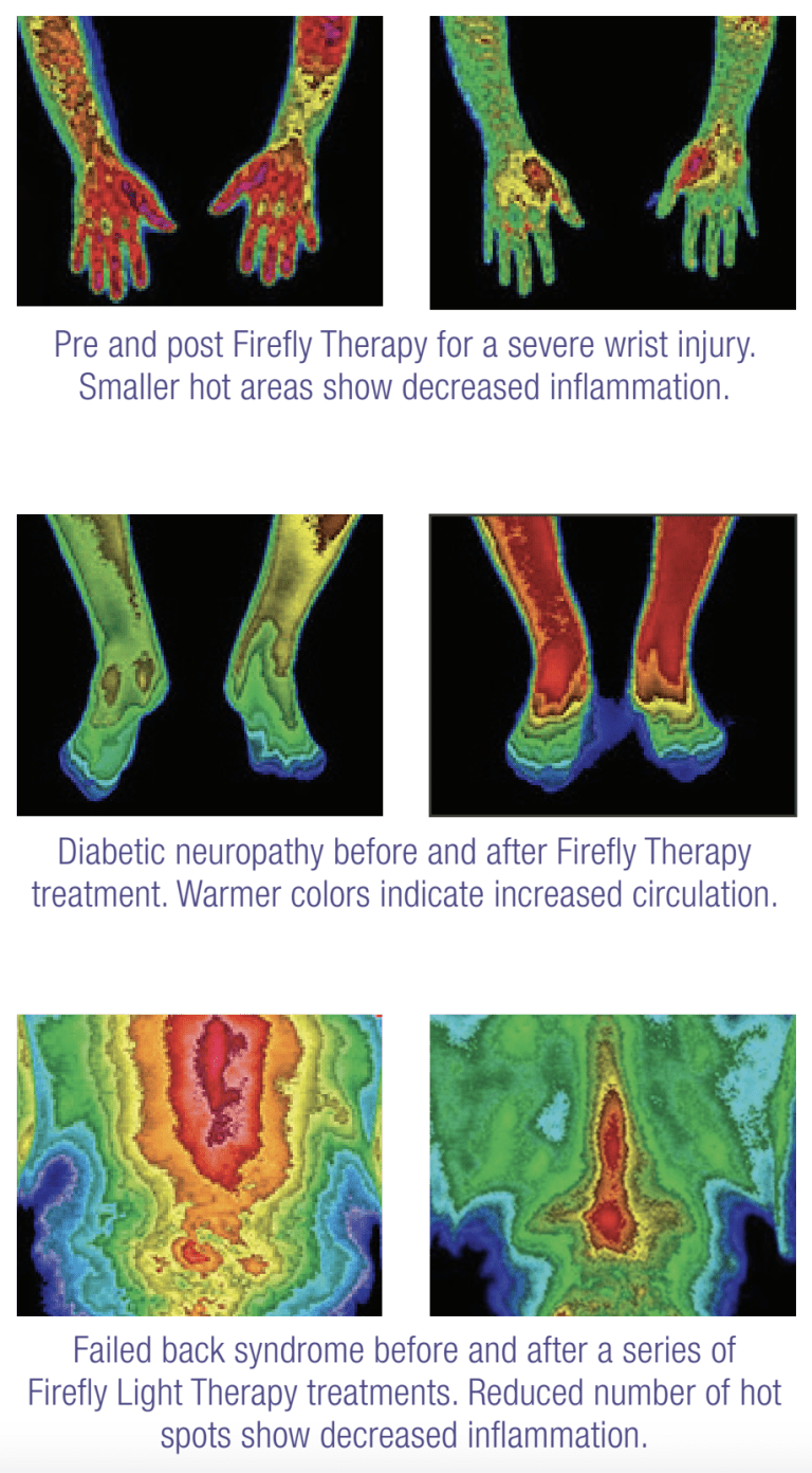 Photonic Stimulation Therapy at the Blatman Health & Wellness